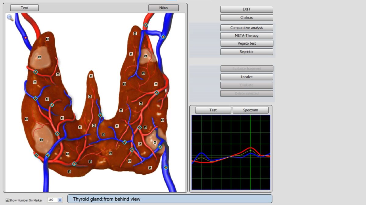 قیمت و خرید دستگاه لوتوس NLS - موج تا ماده | 1404
